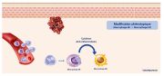 Cicatrisation normale - Phase inflammatoire — PlaieXpertise - Base de ...